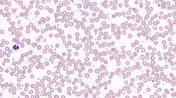 Understanding Blood Smears - Veterinary Pathology Group